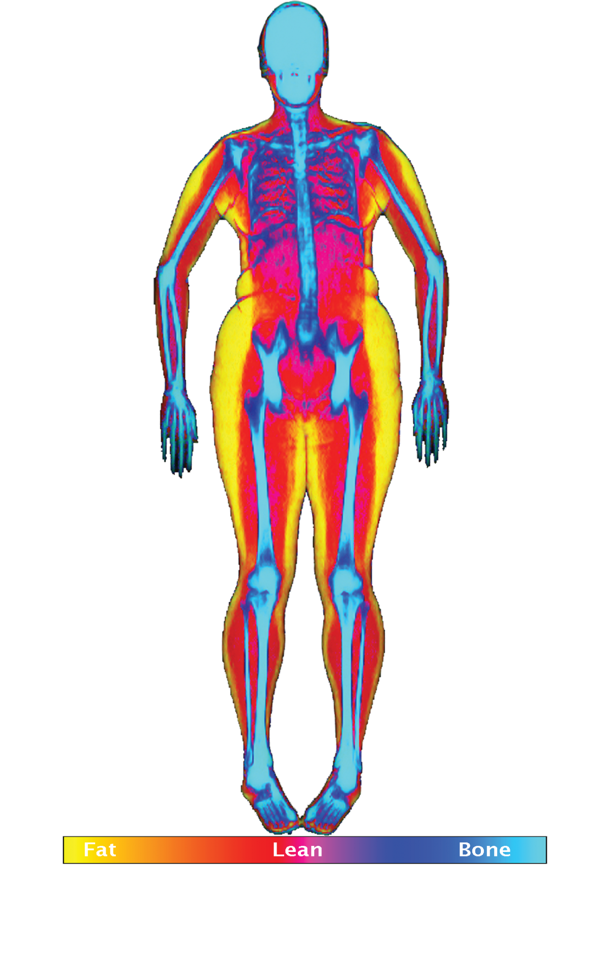 Body with colour chart - Body DEXA Fit - Melbourne DEXA scans