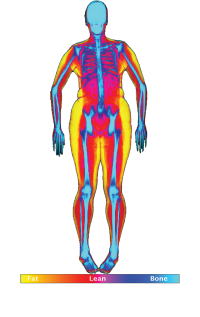 Body with colour chart - Body DEXA Fit - Melbourne DEXA scans