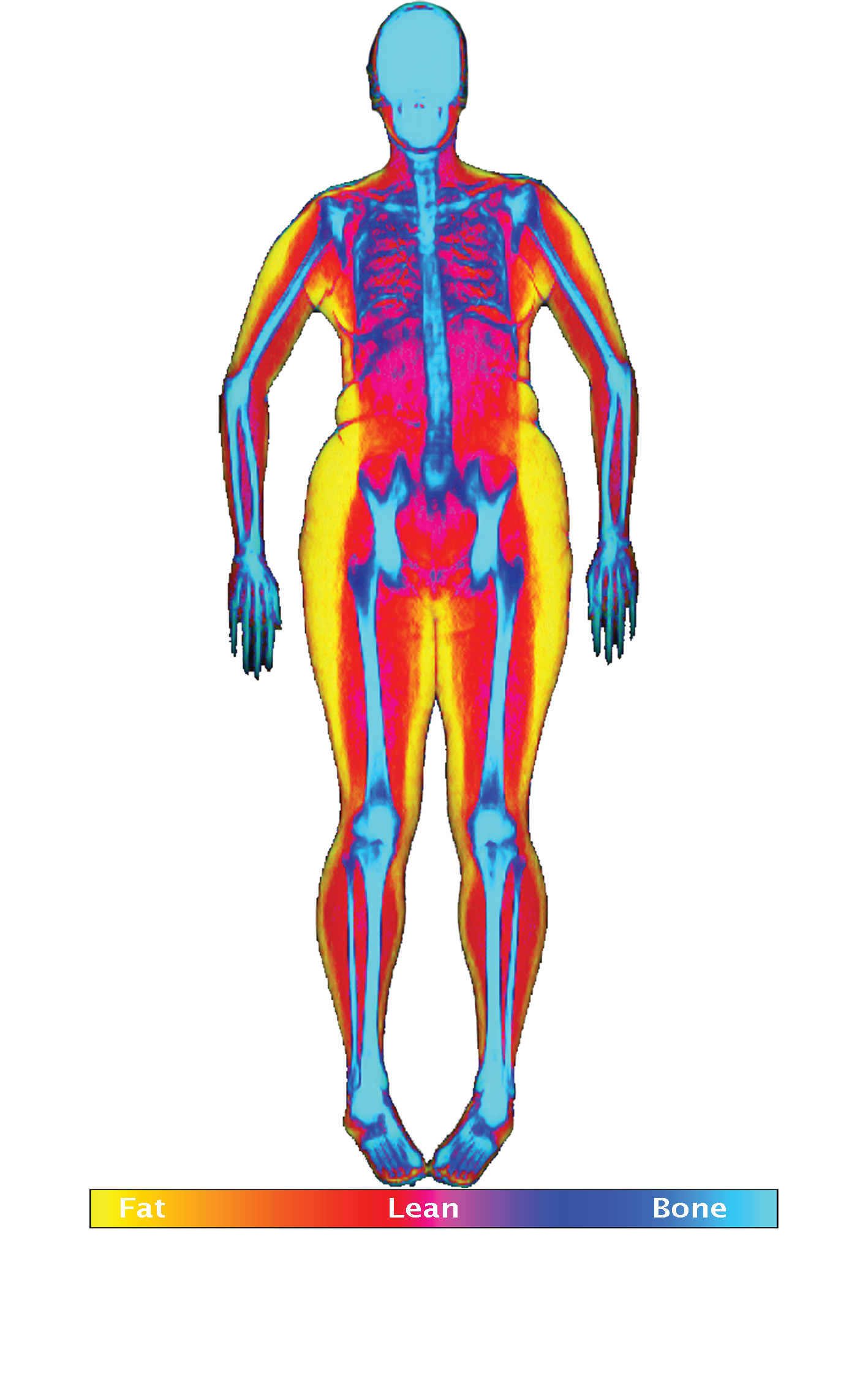 Body With Colour Chart Body DEXA Fit Melbourne DEXA Scans Body With Colour Chart Body DEXA Fit Melbourne DEXA Scans