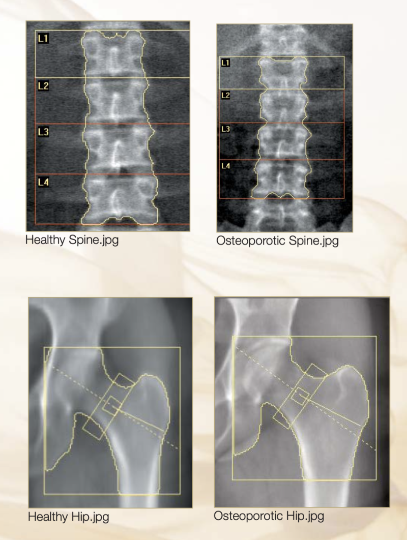 PDF Links | Helpful PDFs - Body DEXA Fit